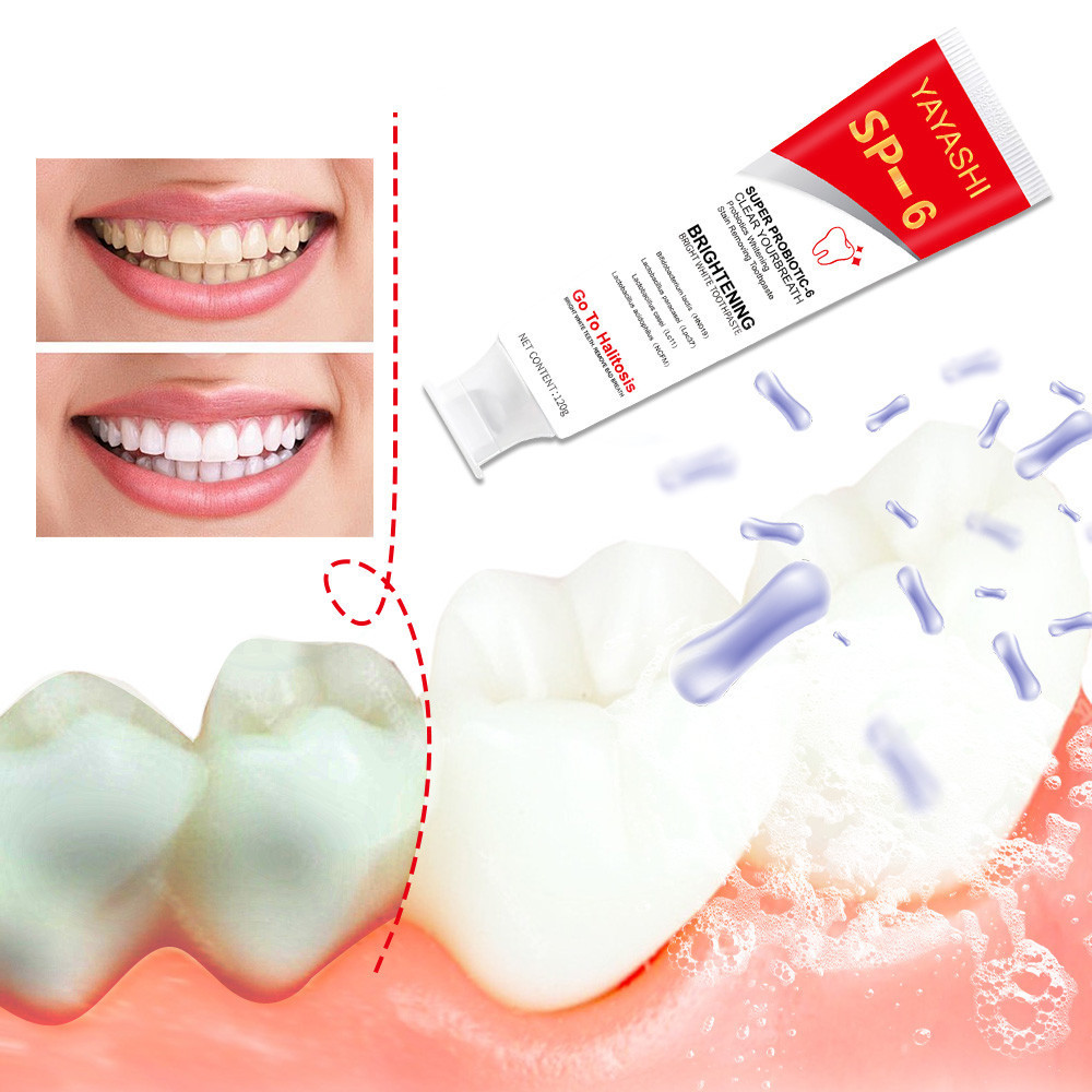 Salorie SP-6 Whitening Toothpaste Probiotic Caries Toothpaste for Bad ...