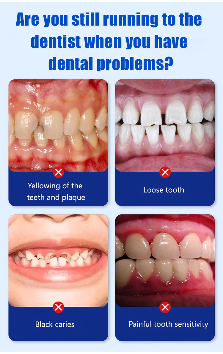 Dental Care Serum Gum Care Deep Cleaning Dirt Serum Oral Care Yellow ...