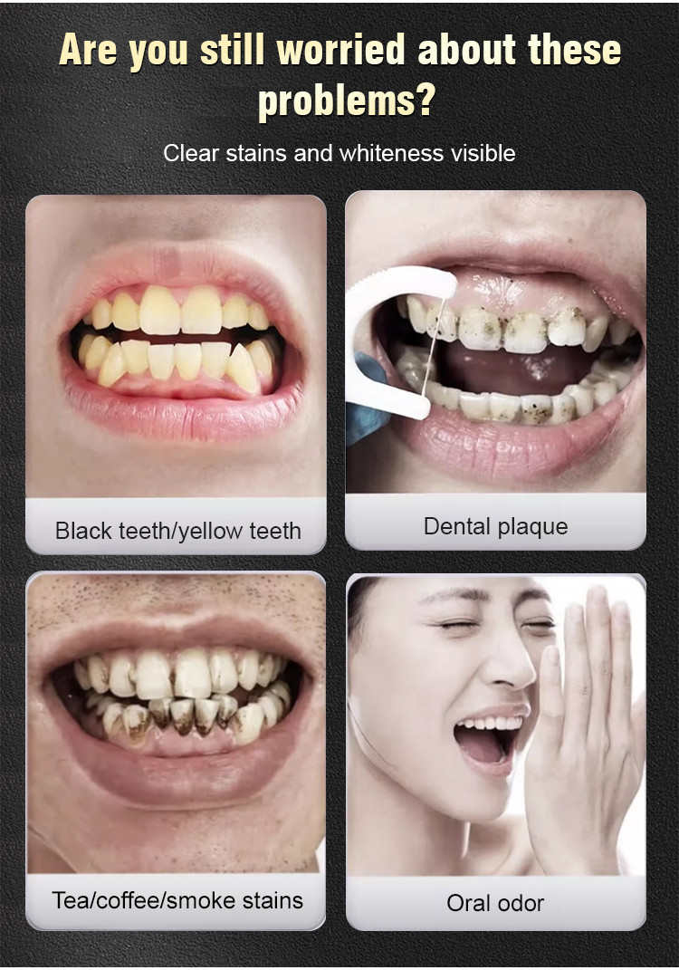 🔥Probiotic Whitening Toothpaste Fresh Breath Remove Smoke And Tea ...