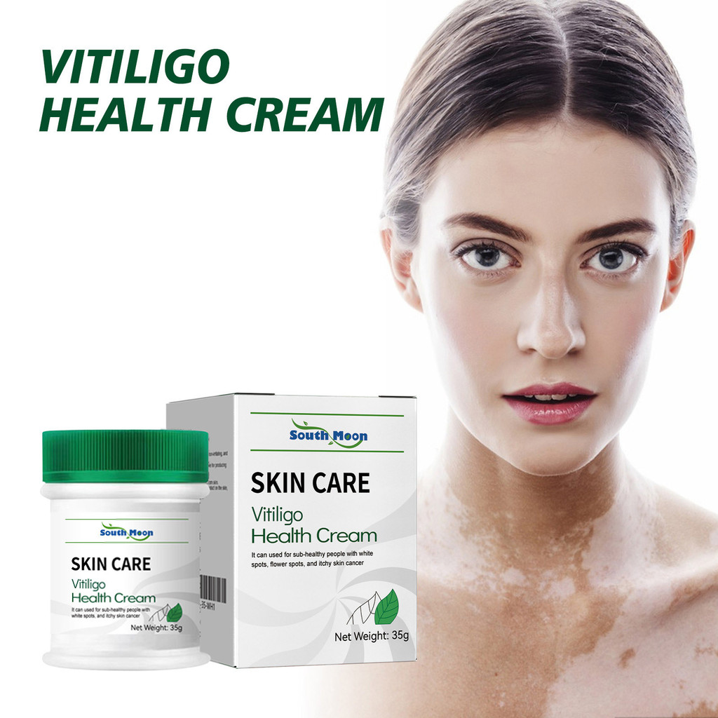 Vitiligo Care Cream Reduce White Spots Improve Skin Pigmentation ...