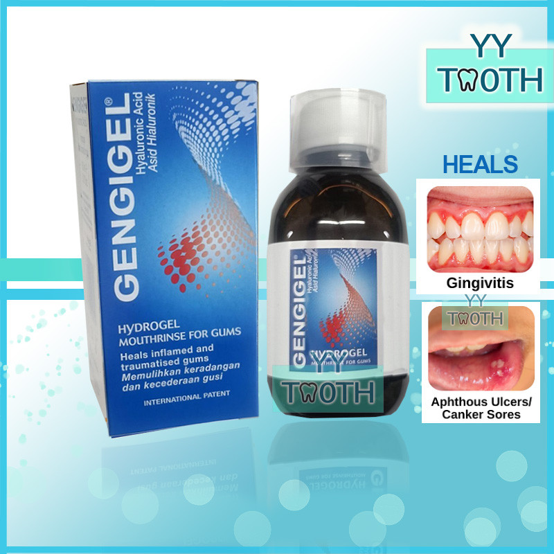 D16D GENGIGEL Hydrogel Mouthrinse for Gums 150ml (exp 12/2027) ubat ...