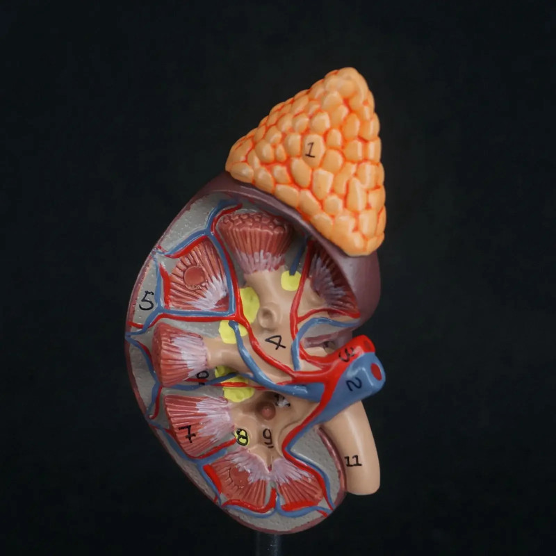 PVC Human Kidney with Adrenal Gland Anatomical Medical Model Urology ...
