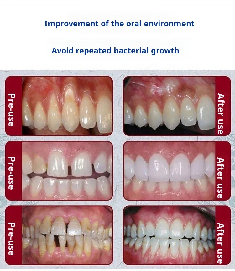 Toothpaste for improved gum swelling pain sensitivity and bleeding ...