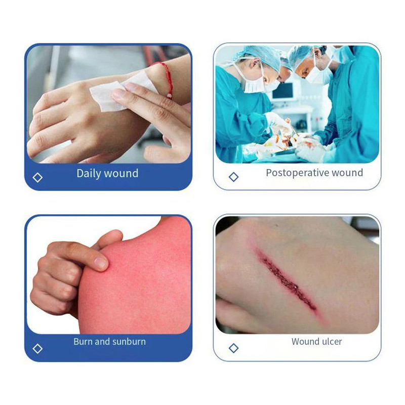 Non-woven Burn Dressing Anti-infection Burns Emergency Bandaging Pad ...