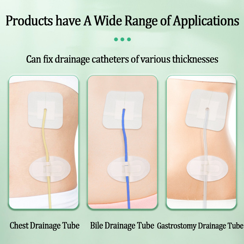 Drainage Hole Catheter Patch Ethylene Oxide Sterile Dressing Peritoneal ...