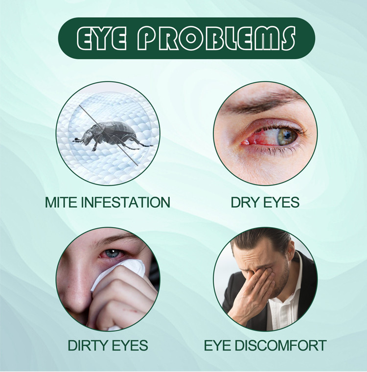 Eye Wipes Remove Eye Fat Improve Safety Moisturize Non-allergenic ...