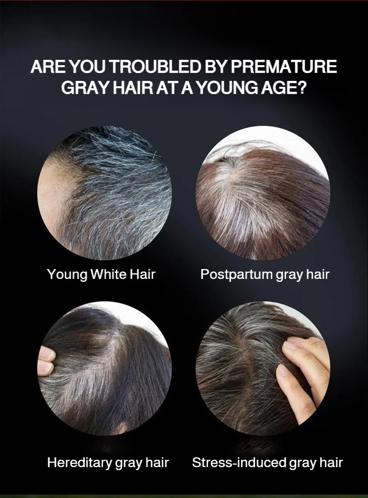 Hair Growth Soap No Residue Soap Hair Strengthening and Hair Loss ...