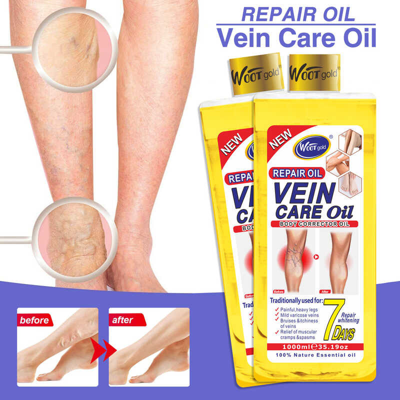 WOOT Vein Soothing Essential Oil Earthworm Leg Soothing Vein Soothing ...
