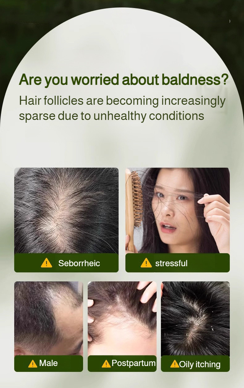 Anti-hair Loss Shampoo Soap Hormone-free Handmade Soap Oil-control ...