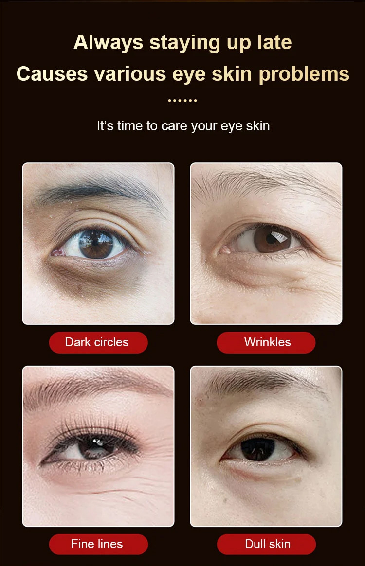 Dinkiss Lutein Eye Serum Brightens and smooths reduces wrinkles and eye ...