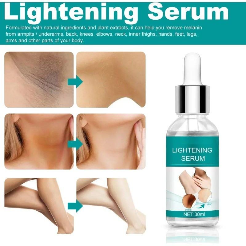 Skin Whitening Serum Private Parts Underarm Bleaching Butt Knee ...