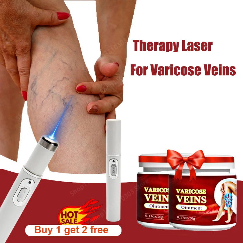 Laser Therapy Varicose Veins Treatment Remove Varicose Vein Effective ...