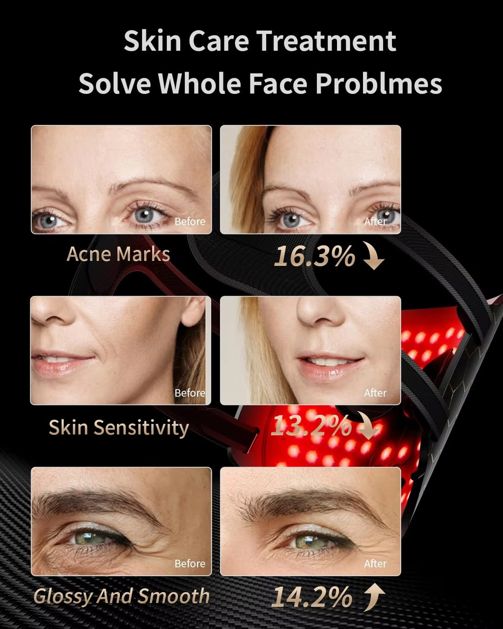 7 Colors LED Photon Face Mask Wearable Skin Rejuvenation for Glowing ...
