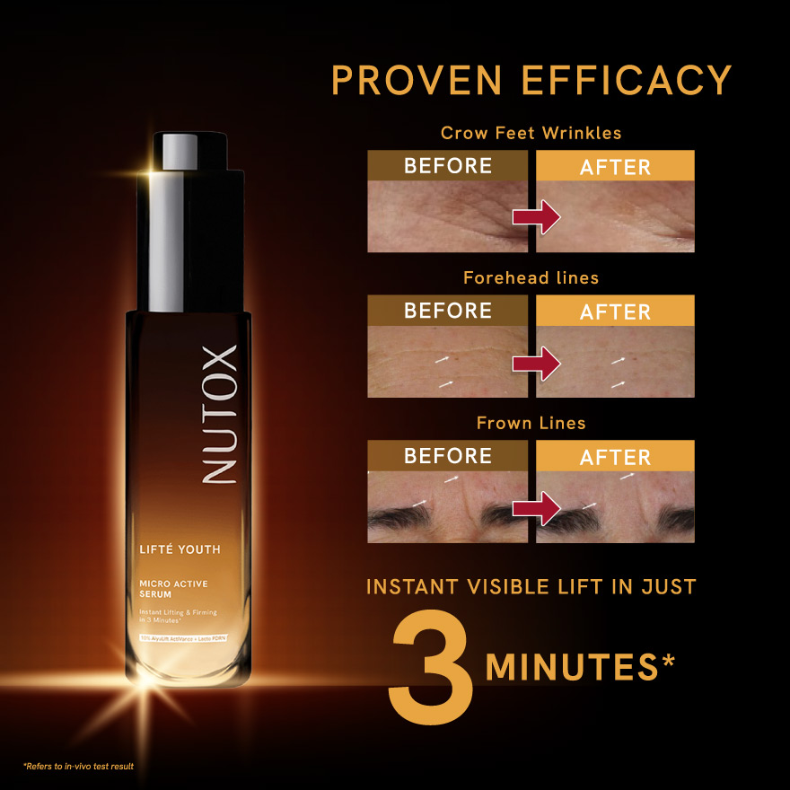 Nutox Lifte Youth Micro Active Serum 30ml | Shopee Malaysia