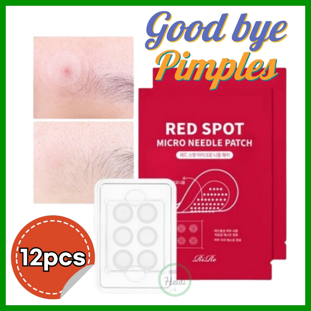 KOREA 🇰🇷 Red Spot Microneedle Pimple Patch / pimple patch with needles ...