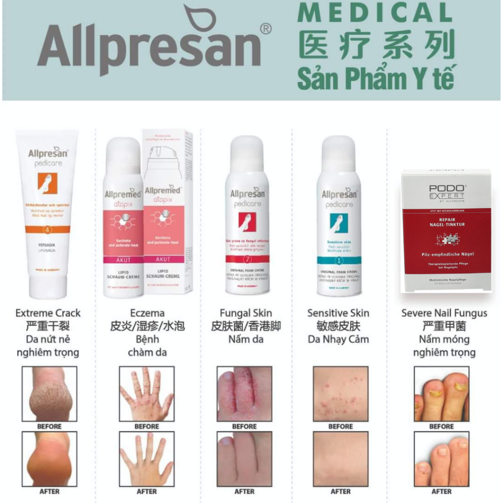 Allpresan pedicare footcare-Lipid Ointment/Atopix Akut/Anti-fungal Skin ...