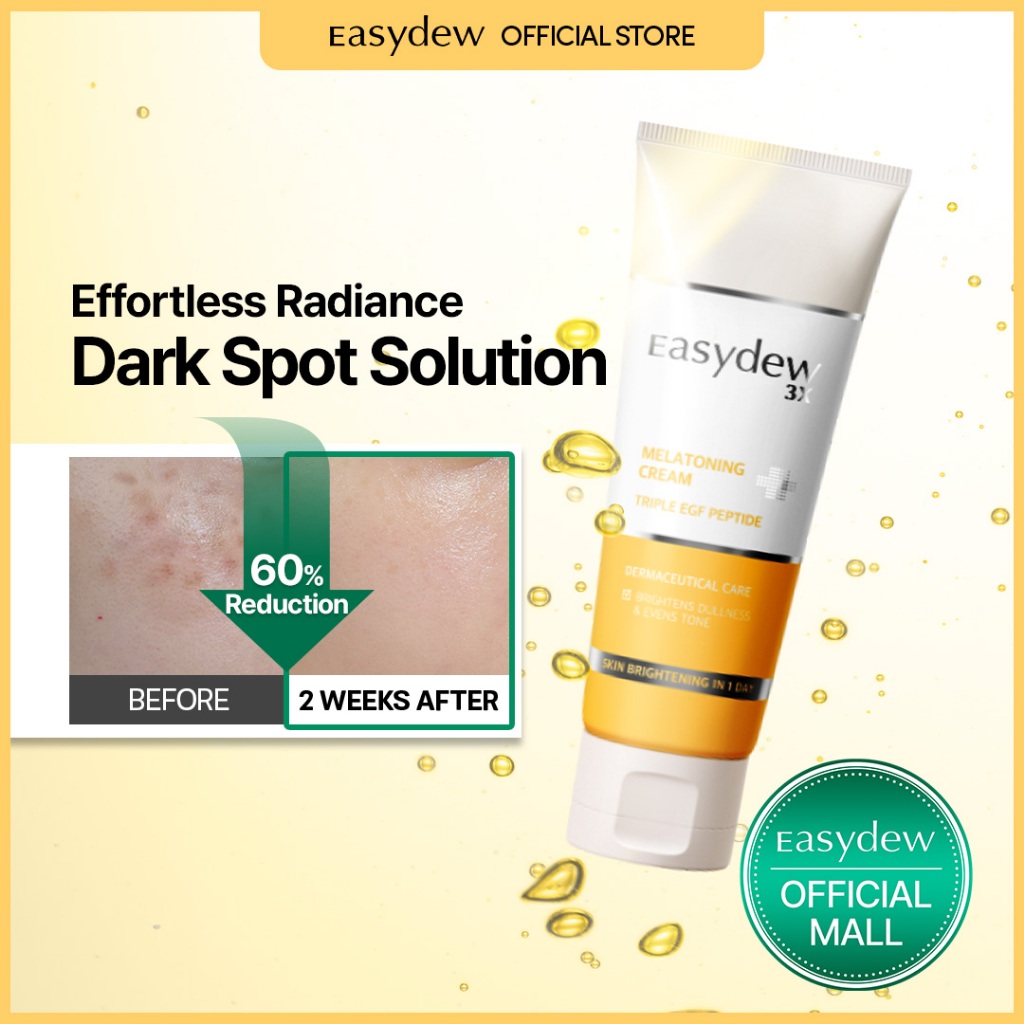 [Easydew] MELATONING CREAM 105ML (freckle & blemish improvement) | Shopee Malaysia