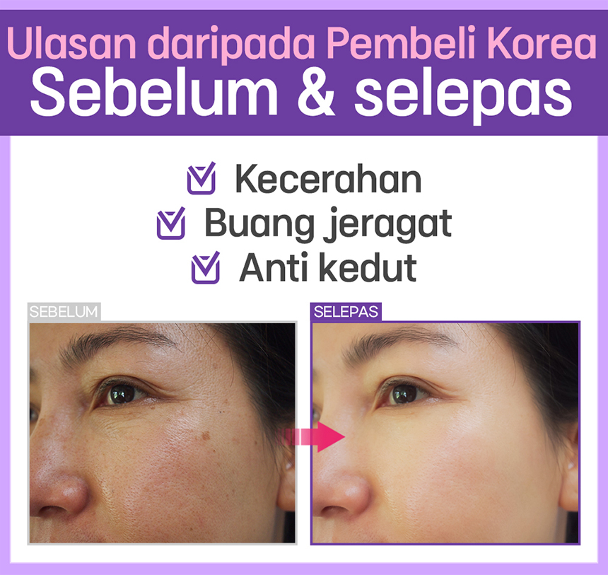 [Tone up Set] BOTO Glutathione Film Direct to Mouth + Glutathione White ...