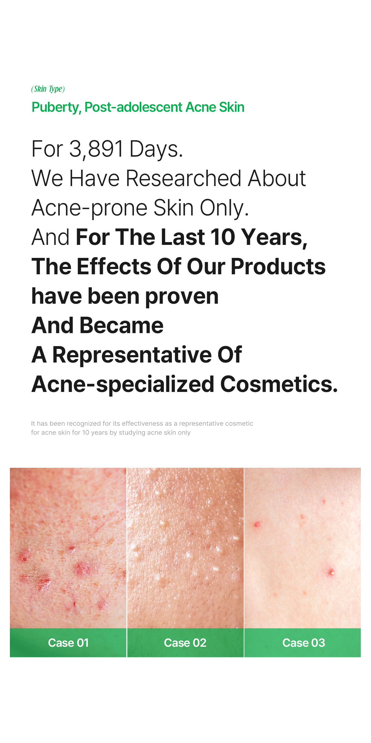 Ultimate Acne&Acne Scar Treatment Set for pimiple care (Set of 4 ...