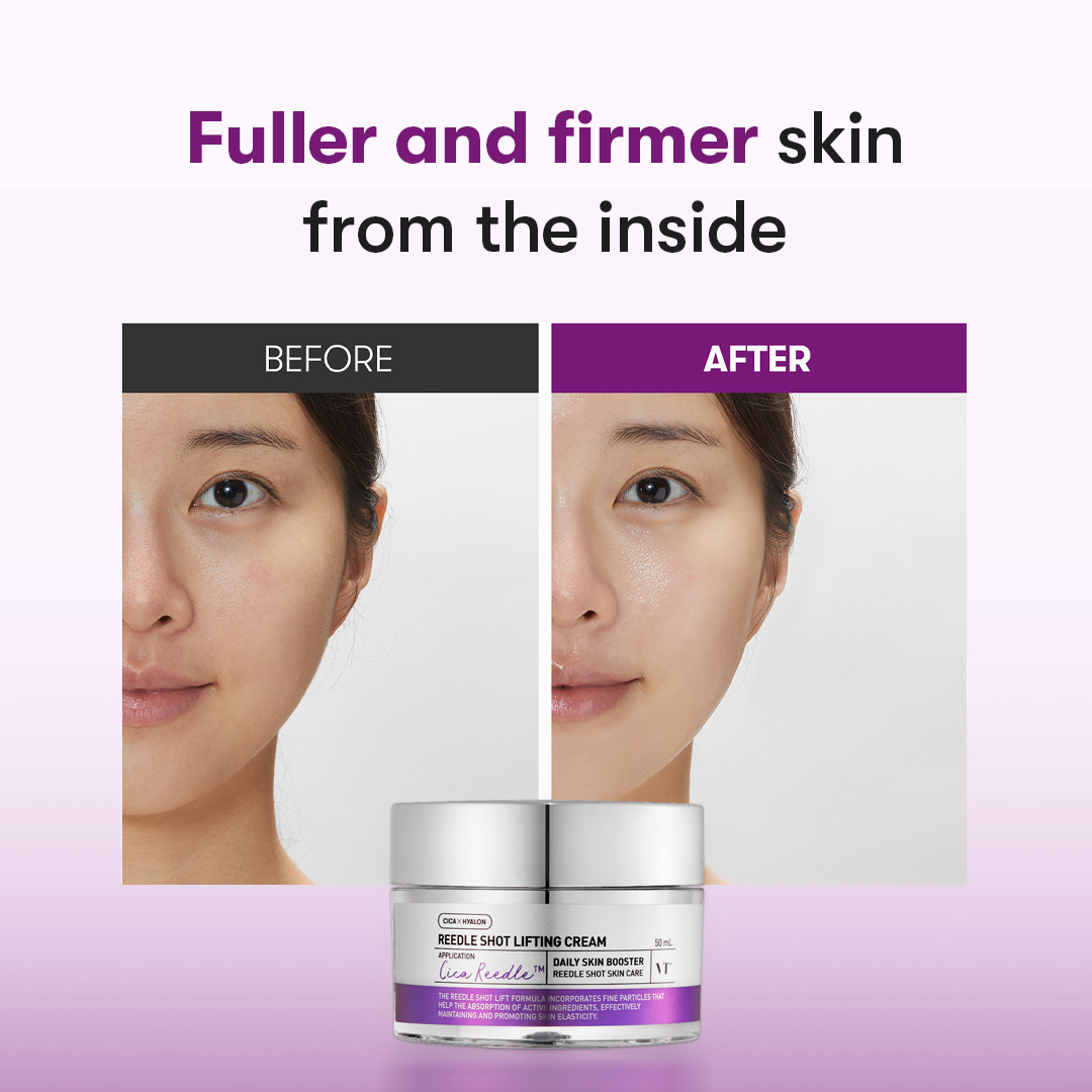 [VT] Reedle Shot Lifting Serum 30ml / Reedle Shot Lifting Cream 50ml ...