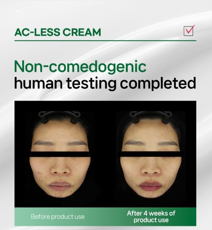 WONJIN EFFECT AC-LESS CREAM | Shopee Malaysia