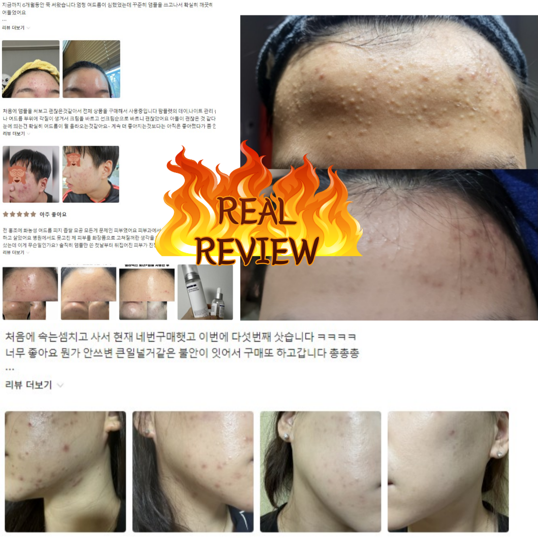 [Celladix] Sebum Rebalancing RX 131 Ampoule 20ml | Tighten Enlarged ...