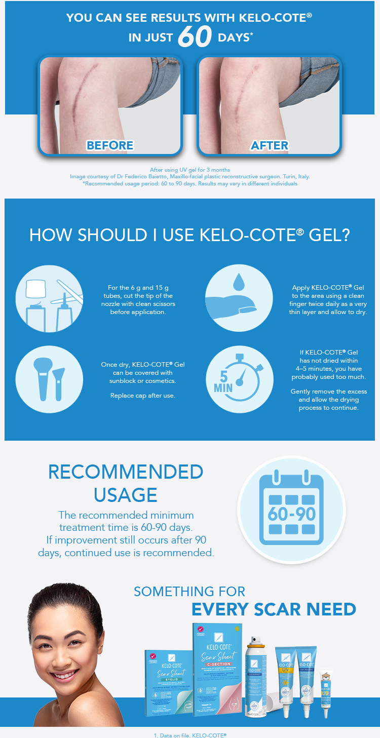 KELO-COTE Advanced Formula Silicone Scar Gel 15g | Scar Treatment for ...