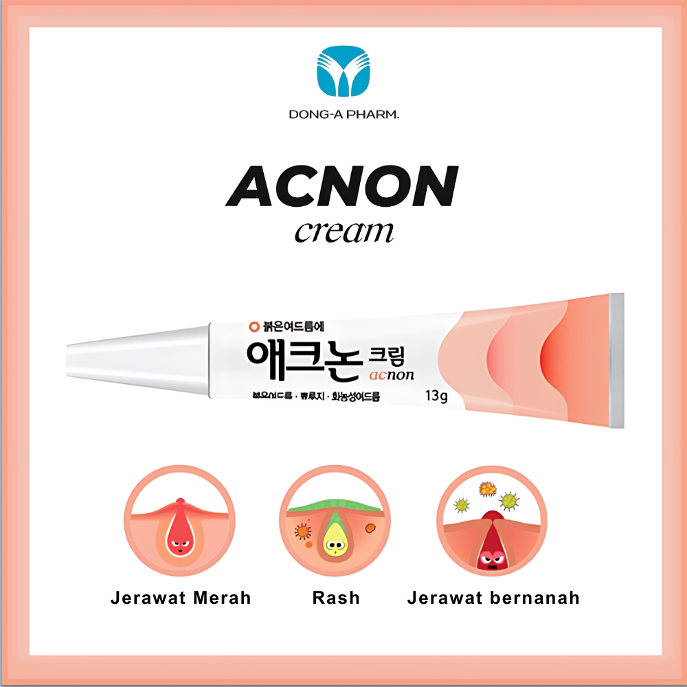 Acnon Cream Acne Treatment Red acne, Pimples, Pustular acne, Whiteheads ...