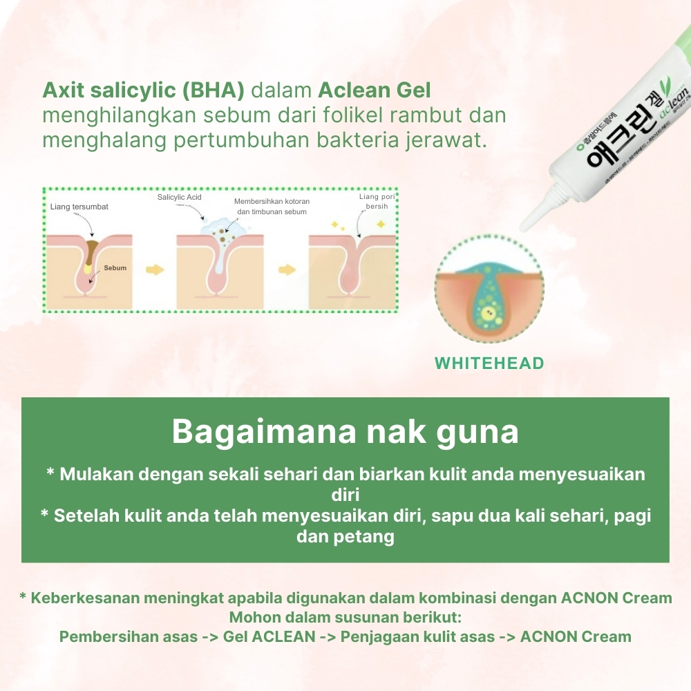 Aclean Gel Acne Treatment Red acne, Pimples, Pustular acne, Whiteheads ...