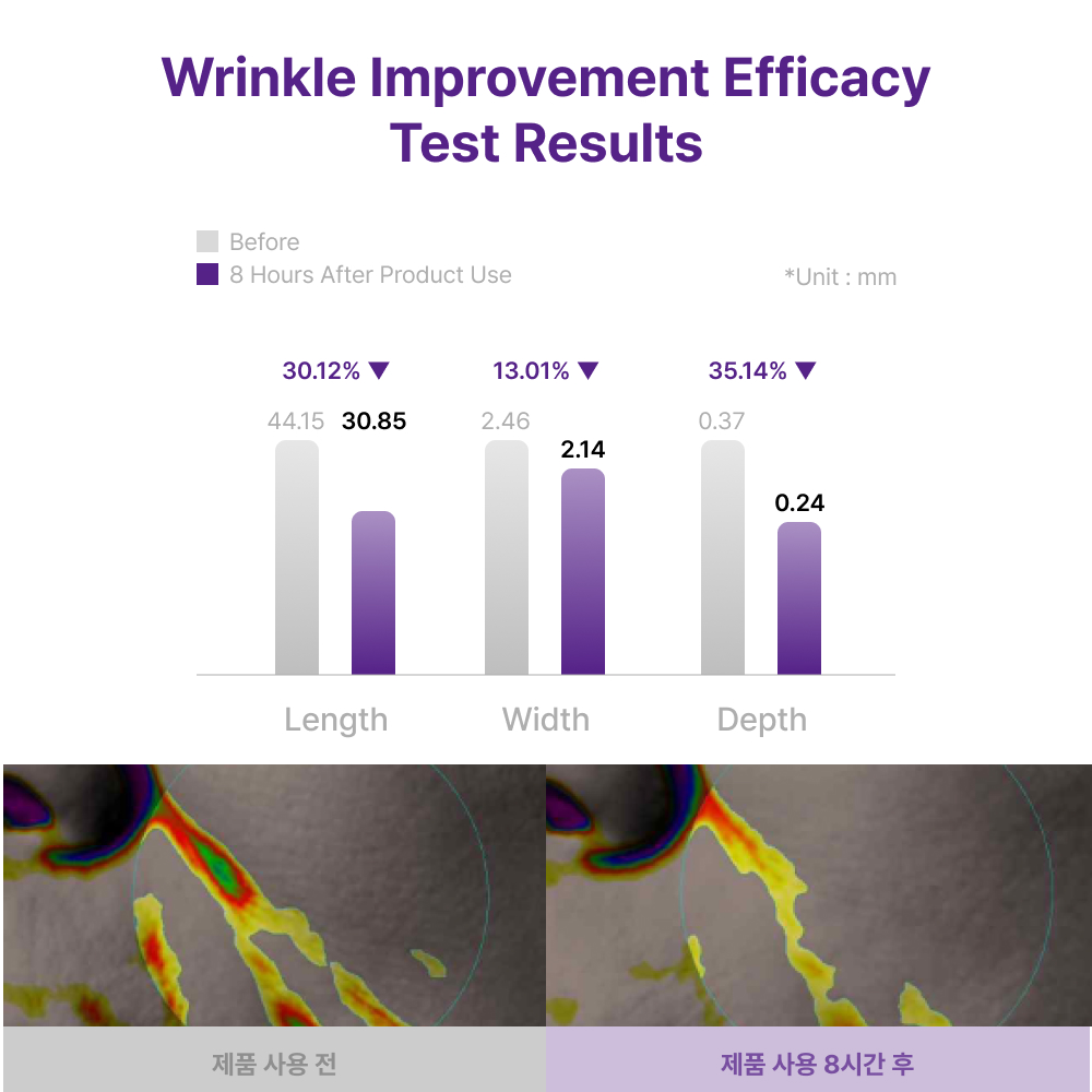 fit:UP Anti-Wrinkle Patch | Retinol + Volufiline | Forehead, Smile ...