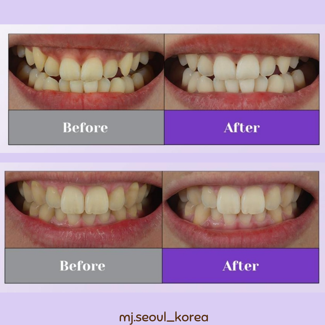 Euthymol whitening purple correcter Original Toothpaste Byeon Woo Seok ...