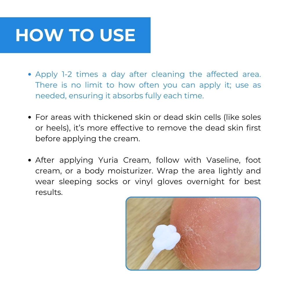 Hanmi Pharmaceutical Yuria Skin Softening Cream for Foot Care ...