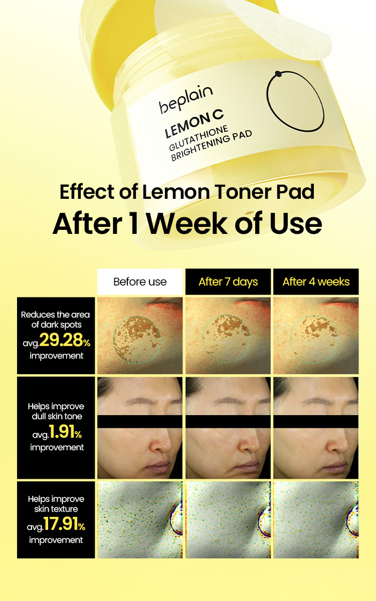 BEPLAIN LEMON C GLUTATHIONE BRIGHTENING PAD 70Pads | Improves skin tone ...