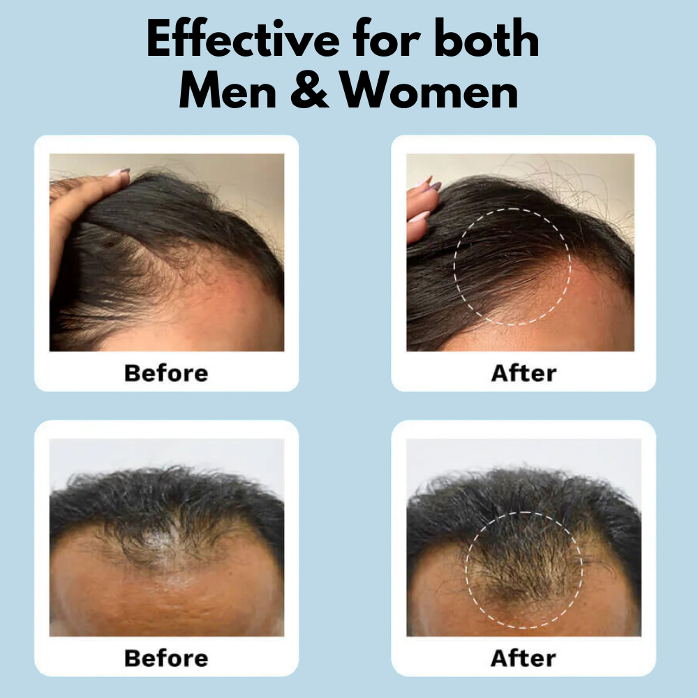 Pilgrim Combo Rosemary Hair Growth Serum 30ml & Water Spray | Hair Fall ...