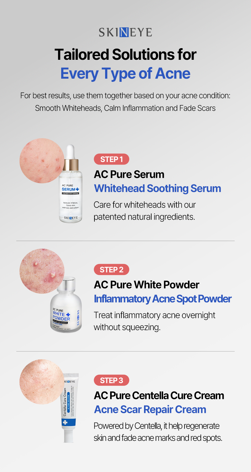 [SKINEYE] AC Pure Centella Cure Cream - 20ml, Korean Pimple Acne Scar ...