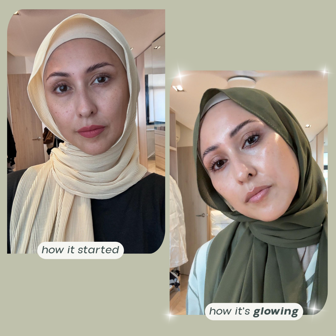 Solulu Glow Up Liquid Collagen Shot + Oral Sunblock | 15 sachets per ...