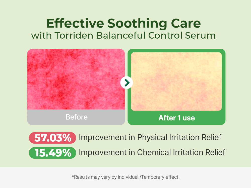 [Torriden Official] BALANCEFUL Cica Control Serum for Acne-prone ...