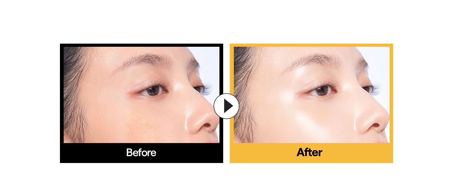 [MEDIHEAL] Essential Mask 7 Types PDRN/Madecassoside/Vitamin C ...
