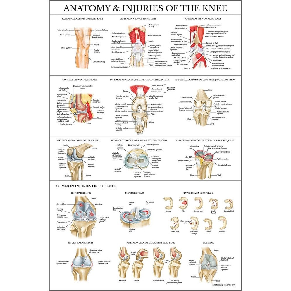 Pretty Canvas Wall Art Laminated Anatomy and Injuries of The Knee ...