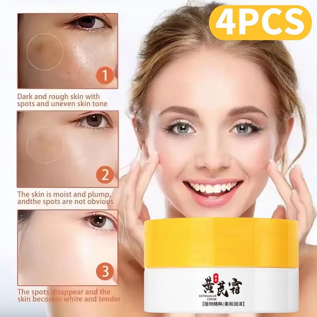 Whitening Astragalus Freckles Cream Lightening Brighten Moisturizing ...