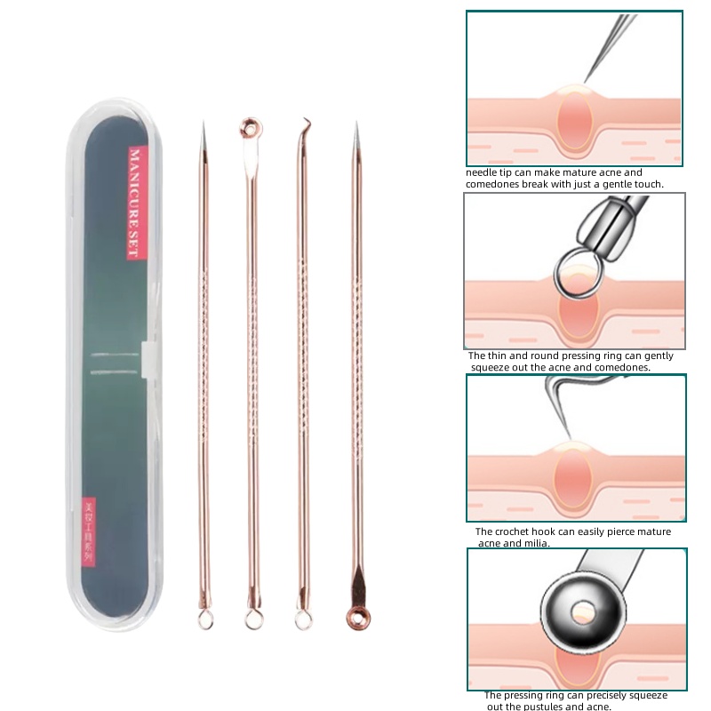 Blackhead Extraction Kit for Acne Facial Rose/Sanded Silver (4-piece ...