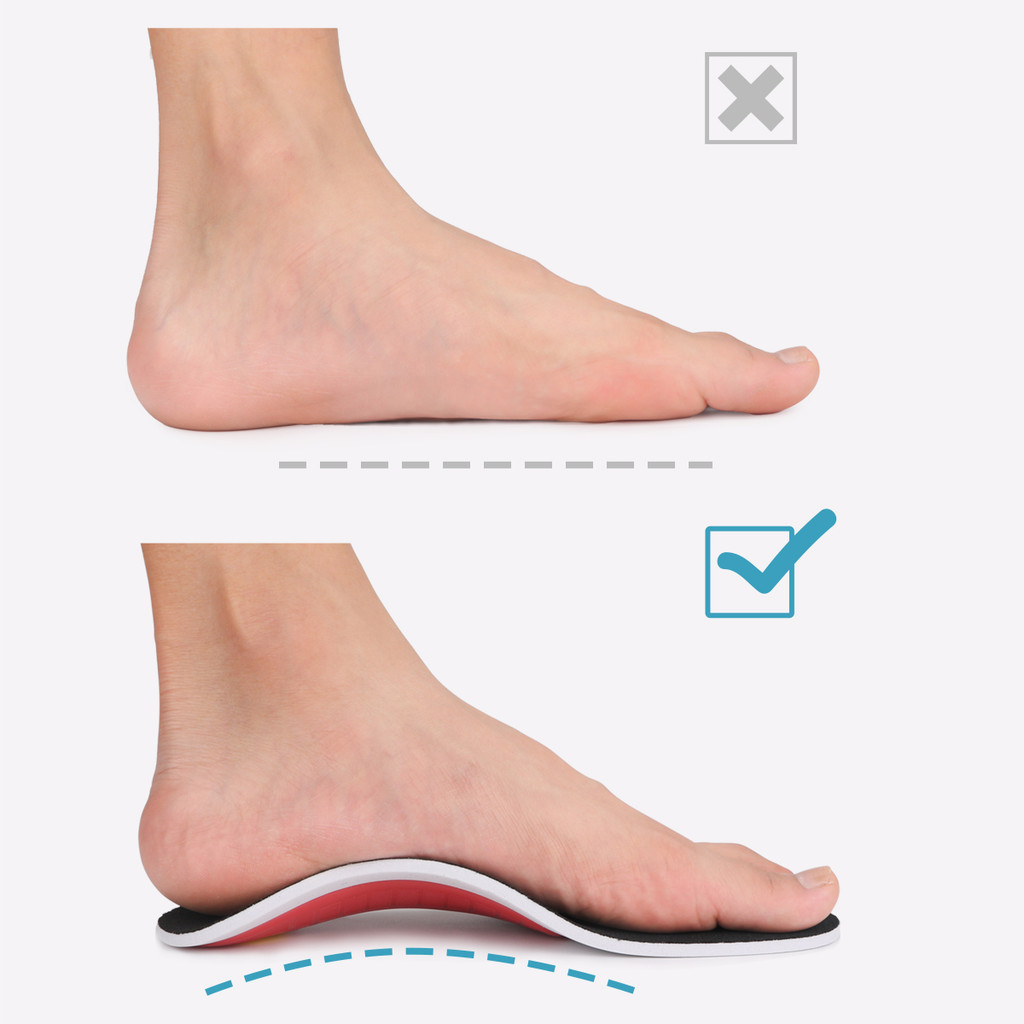 Orthopedic Arch Support Insoles | Shock-Absorbing Inserts for Plantar ...