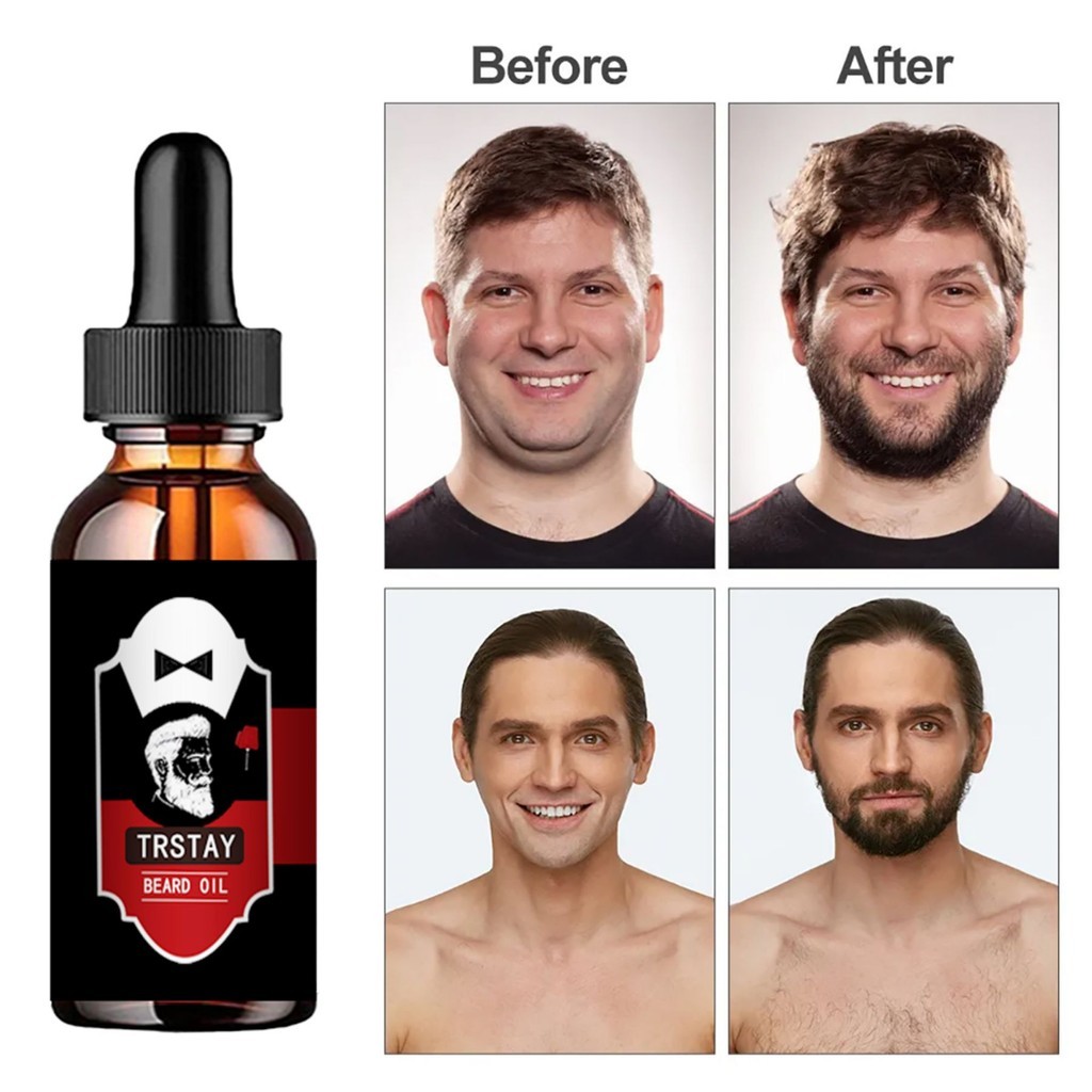 TRSTAY Beard Growth Oil Hair Repair Skin Hair Grow Oil Anti Hair-loss ...