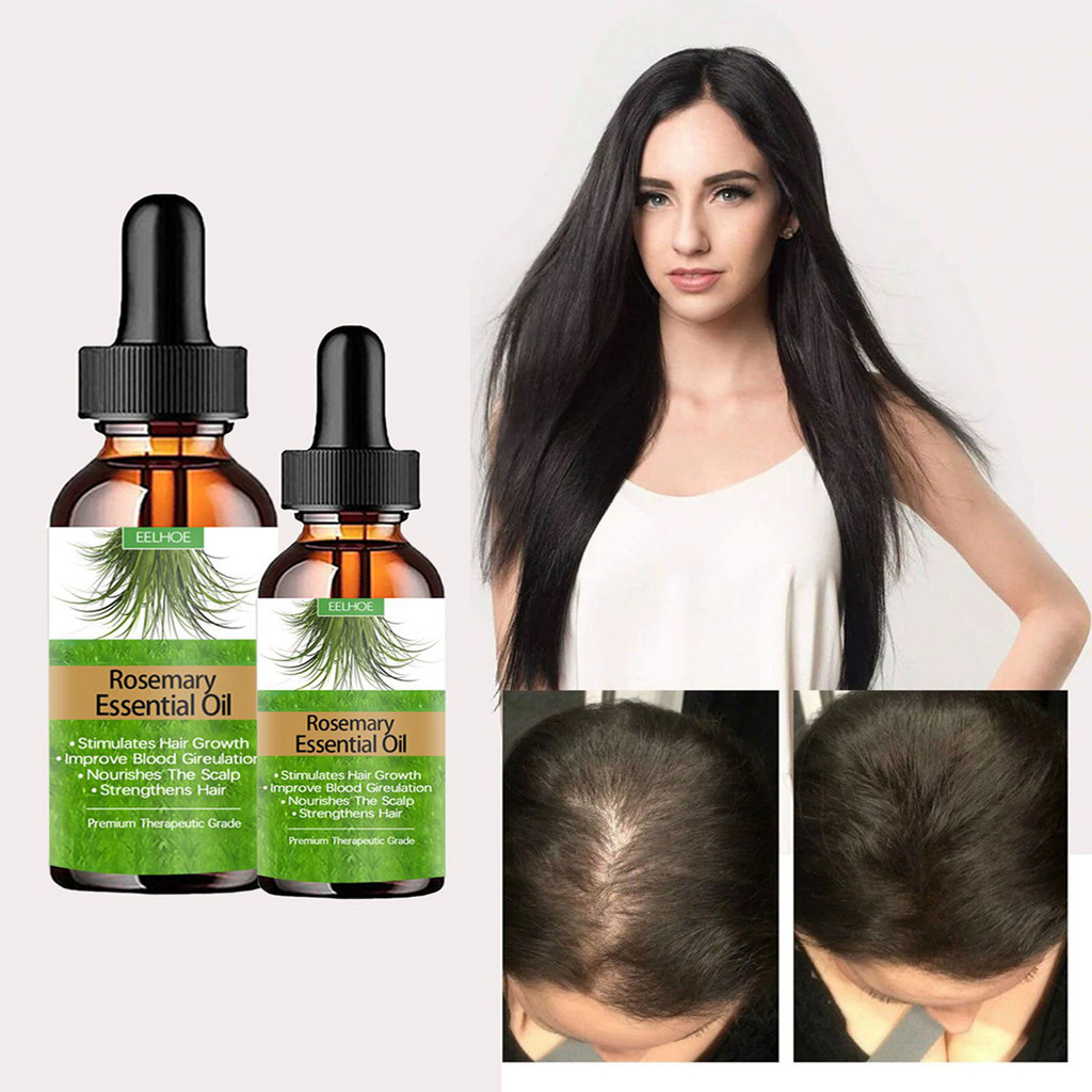 Hairloss Hair Growth Tool Hair Laser Growth Rosemary Mint Scalp ...