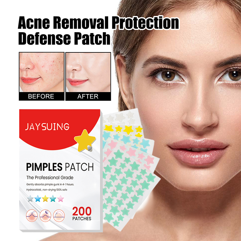 200 Patches Star Pimple Patch Acne Colorful Invisible Acne Removal Skin ...