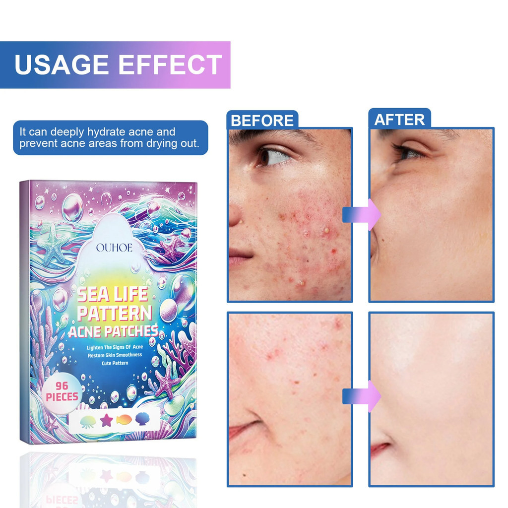 96Pcs Cute Colorful Pimple Patch Relieve Pimple Acne Makeup Concealer ...