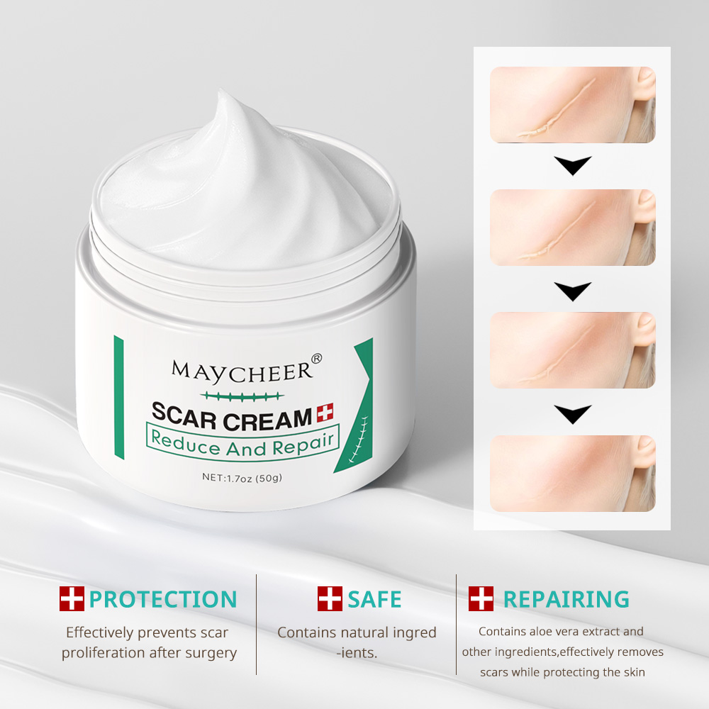 Scar Cream for Reducing and Repairing Scars on Face and Body ...
