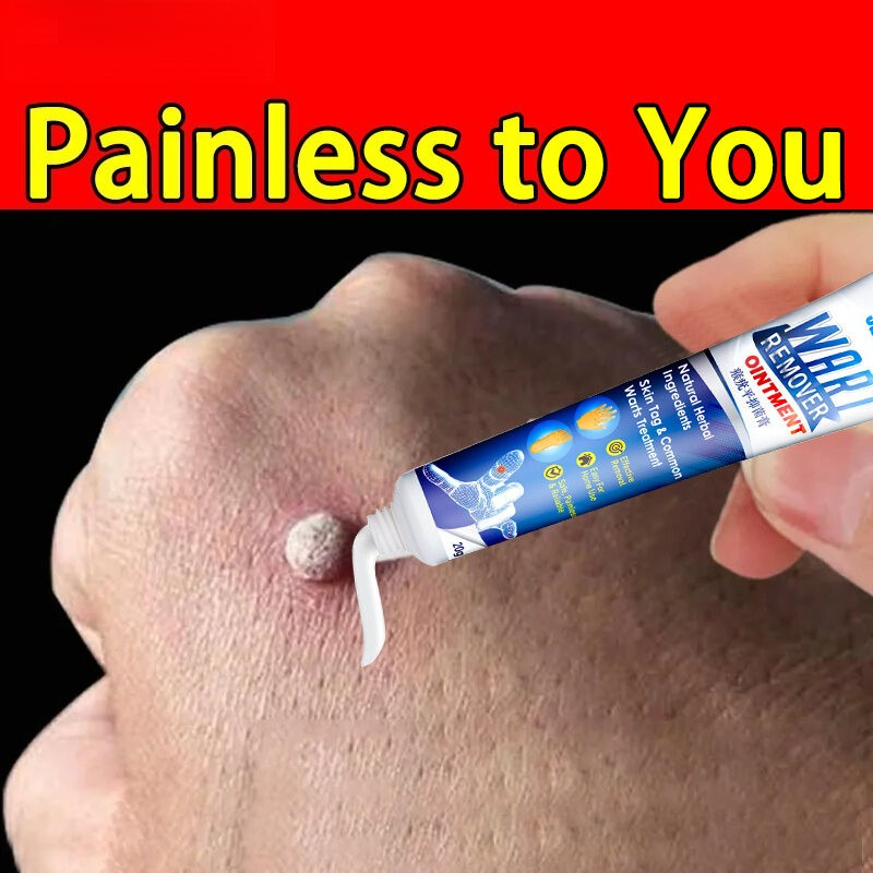 Skin Tags Smooth Cream 20g - Painless Mole Skin Dark Spot Warts Smooth ...