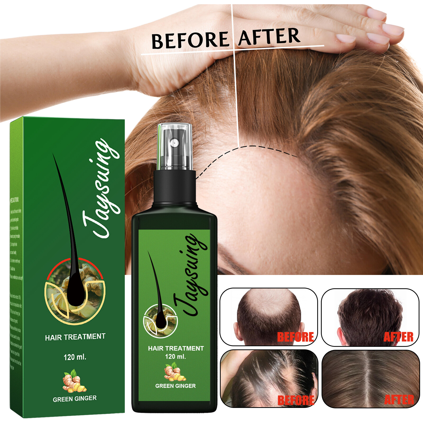 Jaysuing Ginger Hair Growth Spray 120ml – 2 Pack, Natural Hair Growth ...