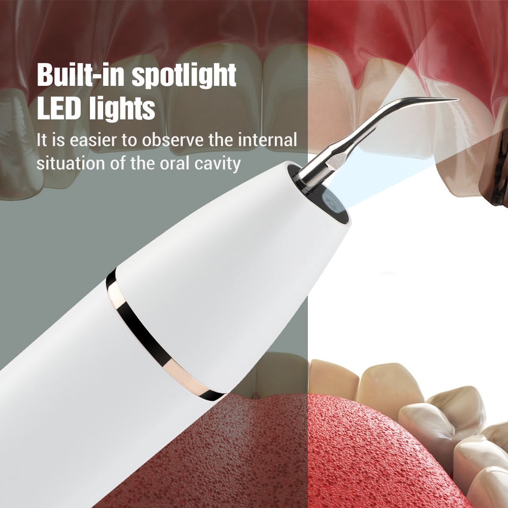 Electric Visual Teeth Whitening Dental Scaler for Teeth Calculus Plaque ...